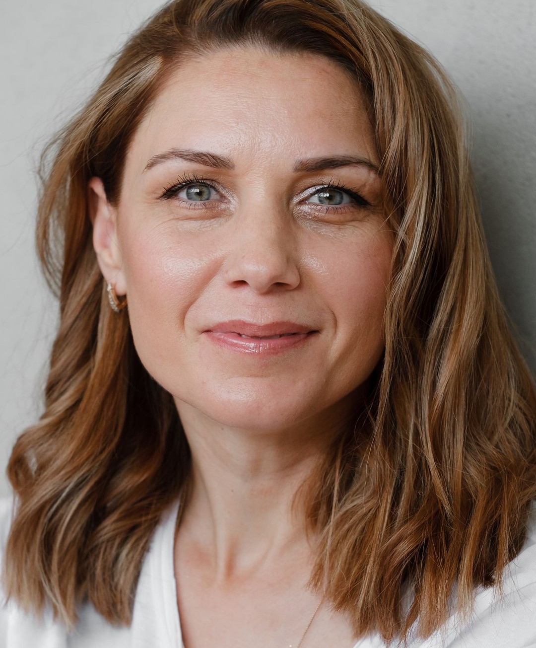 Dermal Fillers in Albuquerque | Elizabeth MD Facial Plastic Surgery